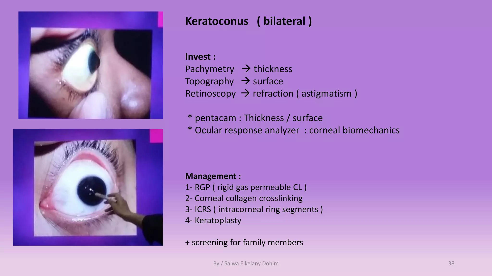 Ophthalmology OSCE | PDF