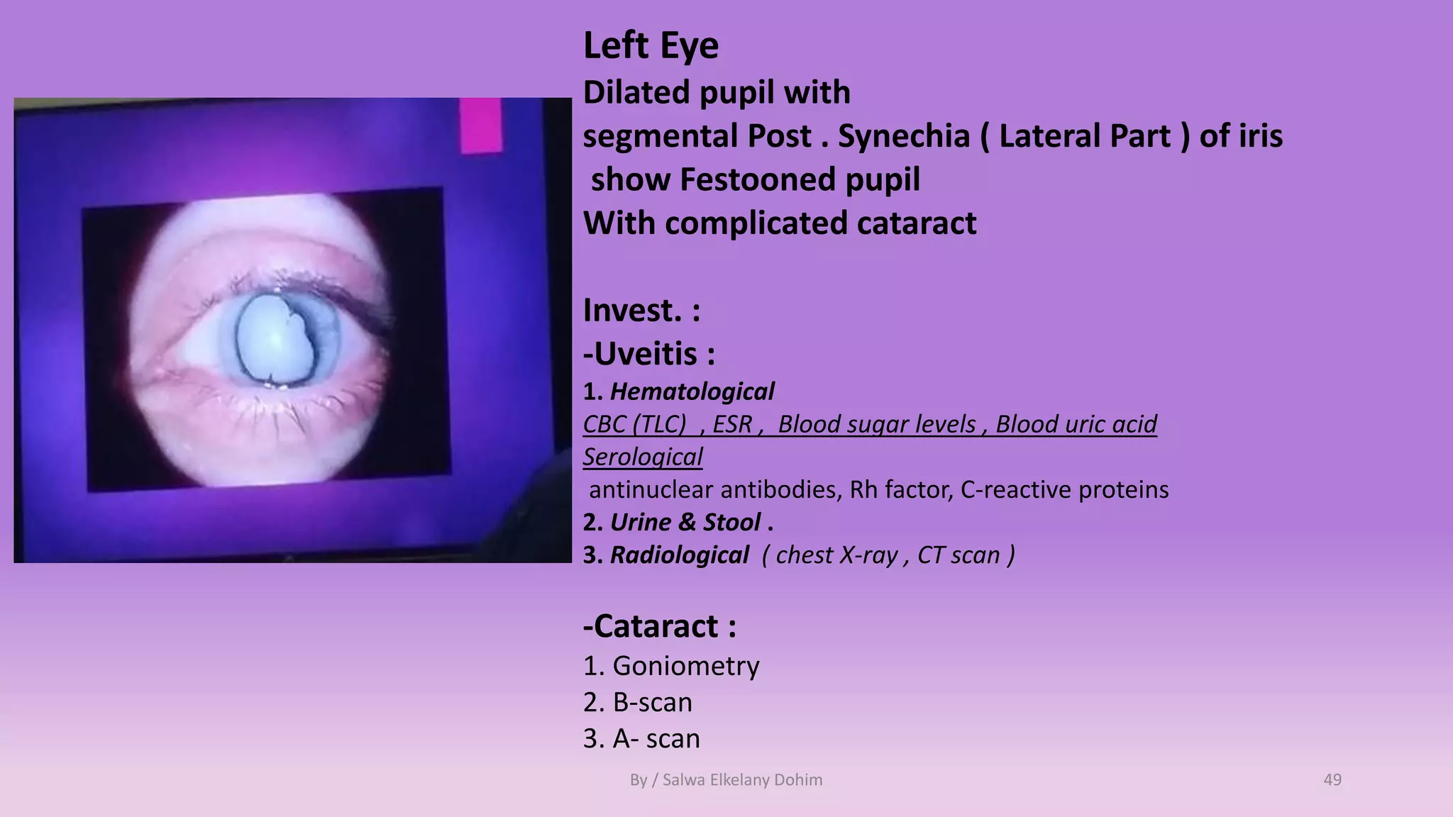 Ophthalmology OSCE | PDF
