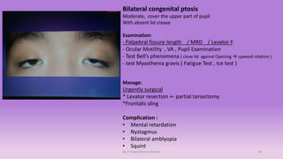 Ophthalmology OSCE | PDF