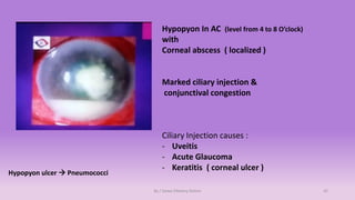 Ophthalmology OSCE | PDF