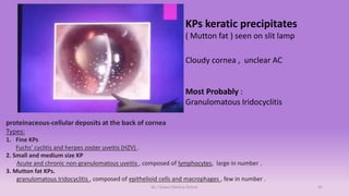 Ophthalmology OSCE | PDF
