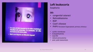Ophthalmology OSCE | PDF