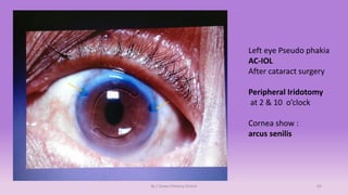 Ophthalmology OSCE | PDF