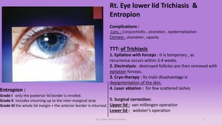 Ophthalmology OSCE | PDF