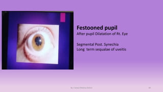 Ophthalmology OSCE | PPT