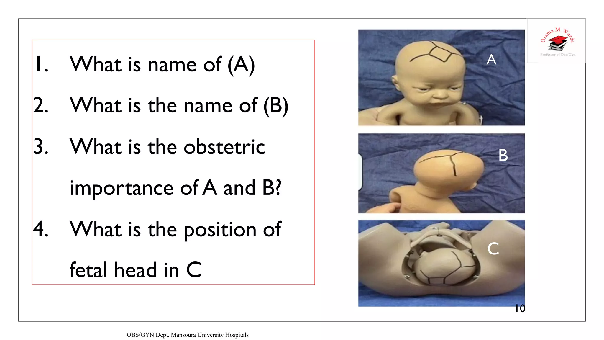 1 Obstetrics & gynecology OSCE -REVISION-1 | PDF