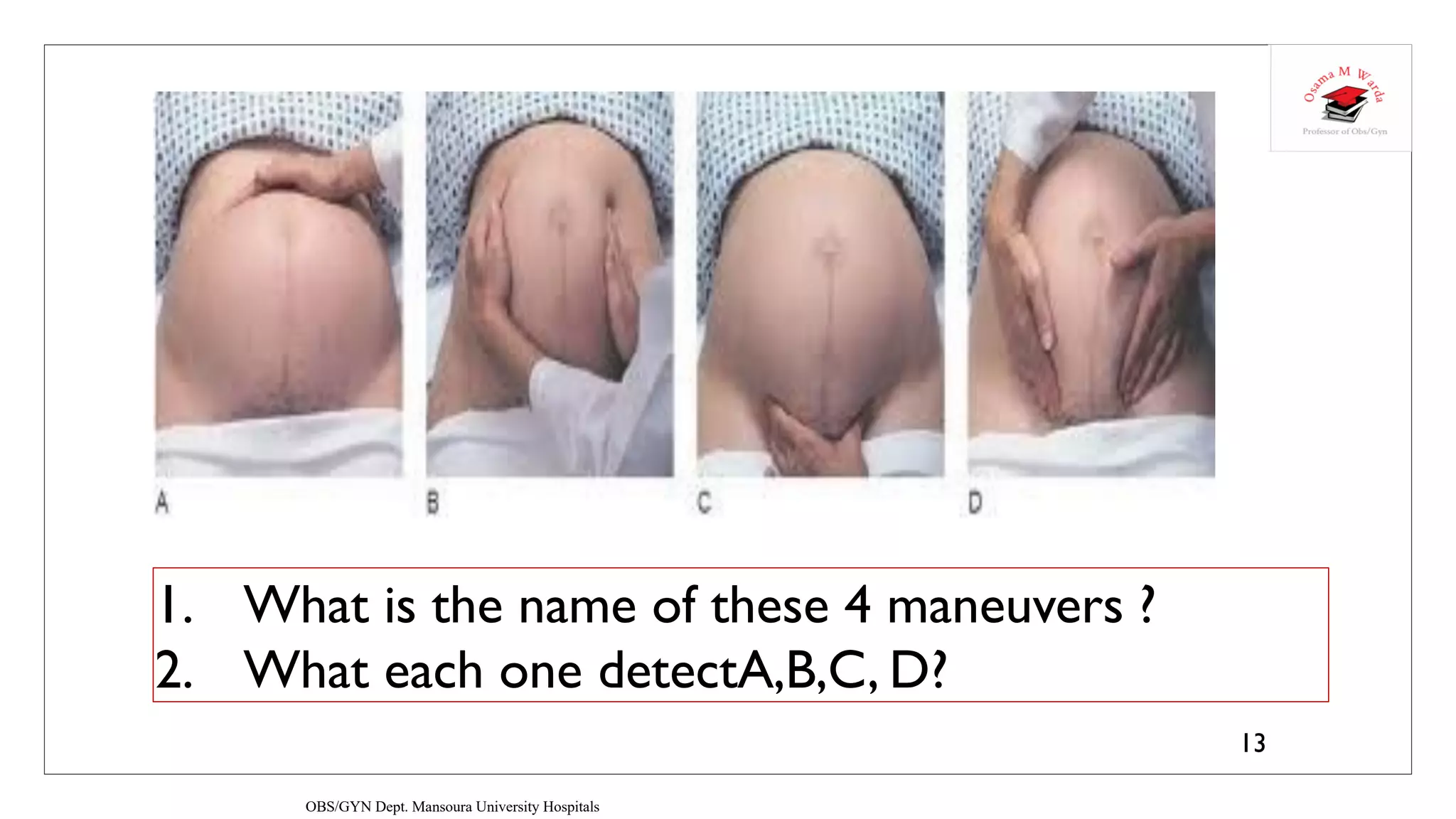 1 Obstetrics & gynecology OSCE -REVISION-1 | PDF