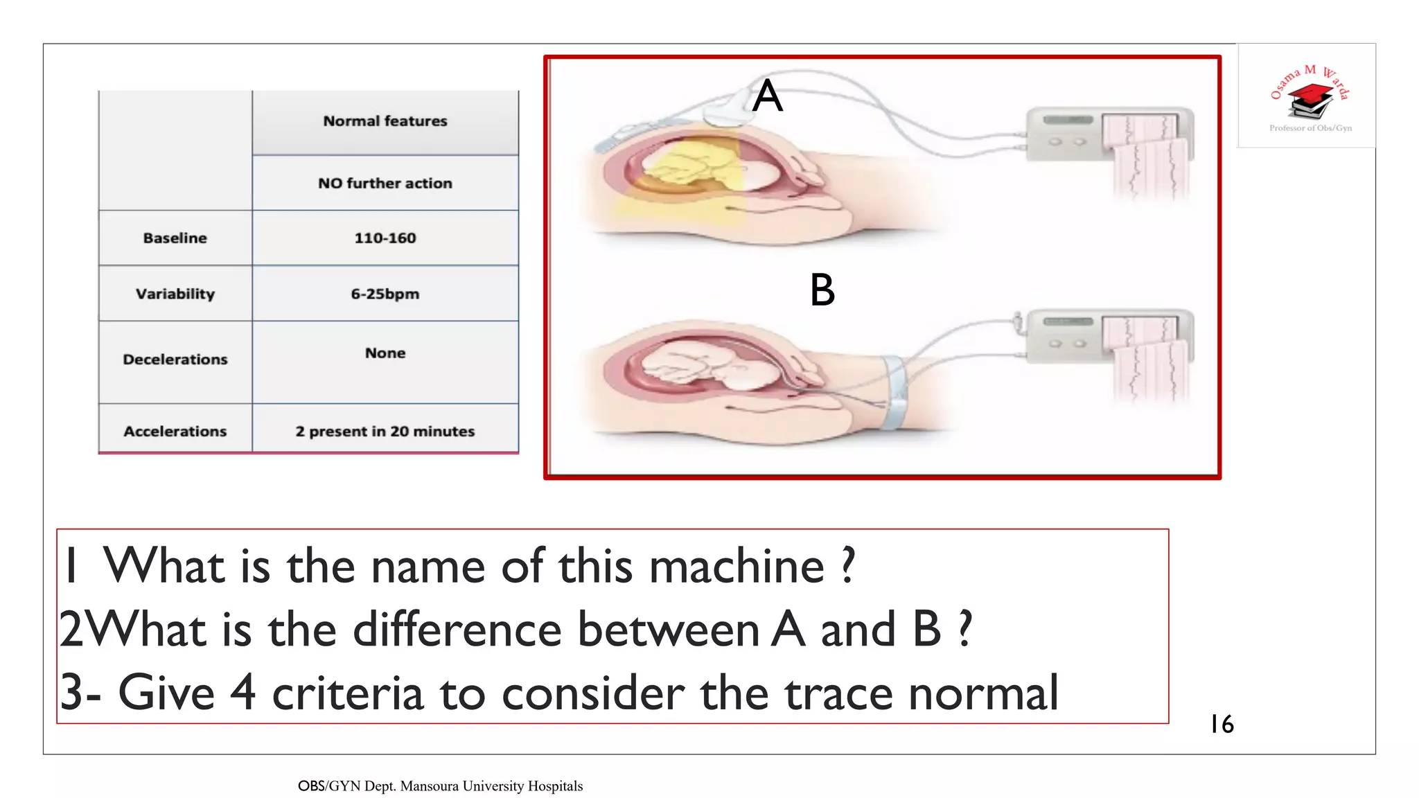 1 Obstetrics & gynecology OSCE -REVISION-1 | PDF