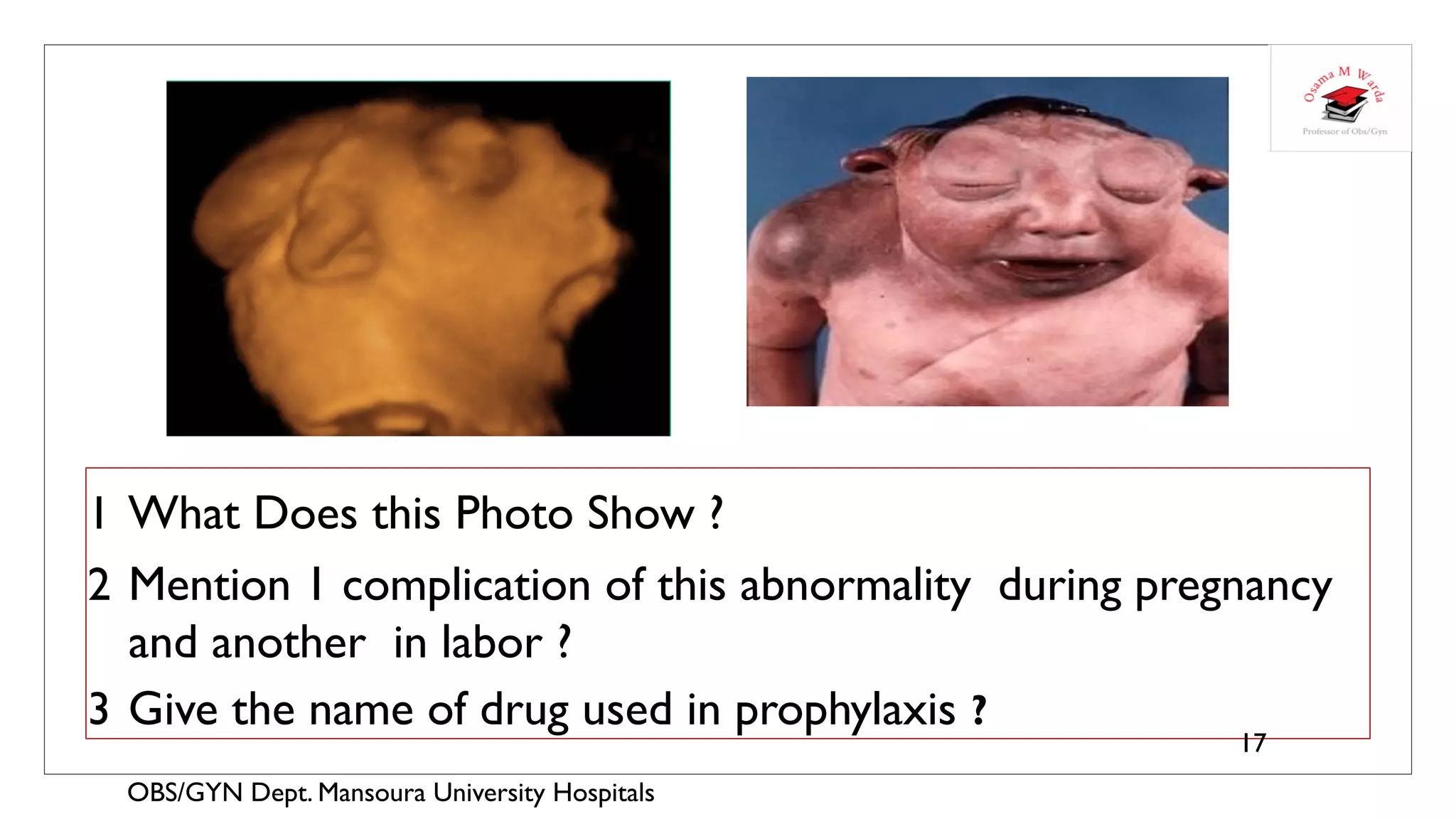 1 Obstetrics & gynecology OSCE -REVISION-1 | PDF