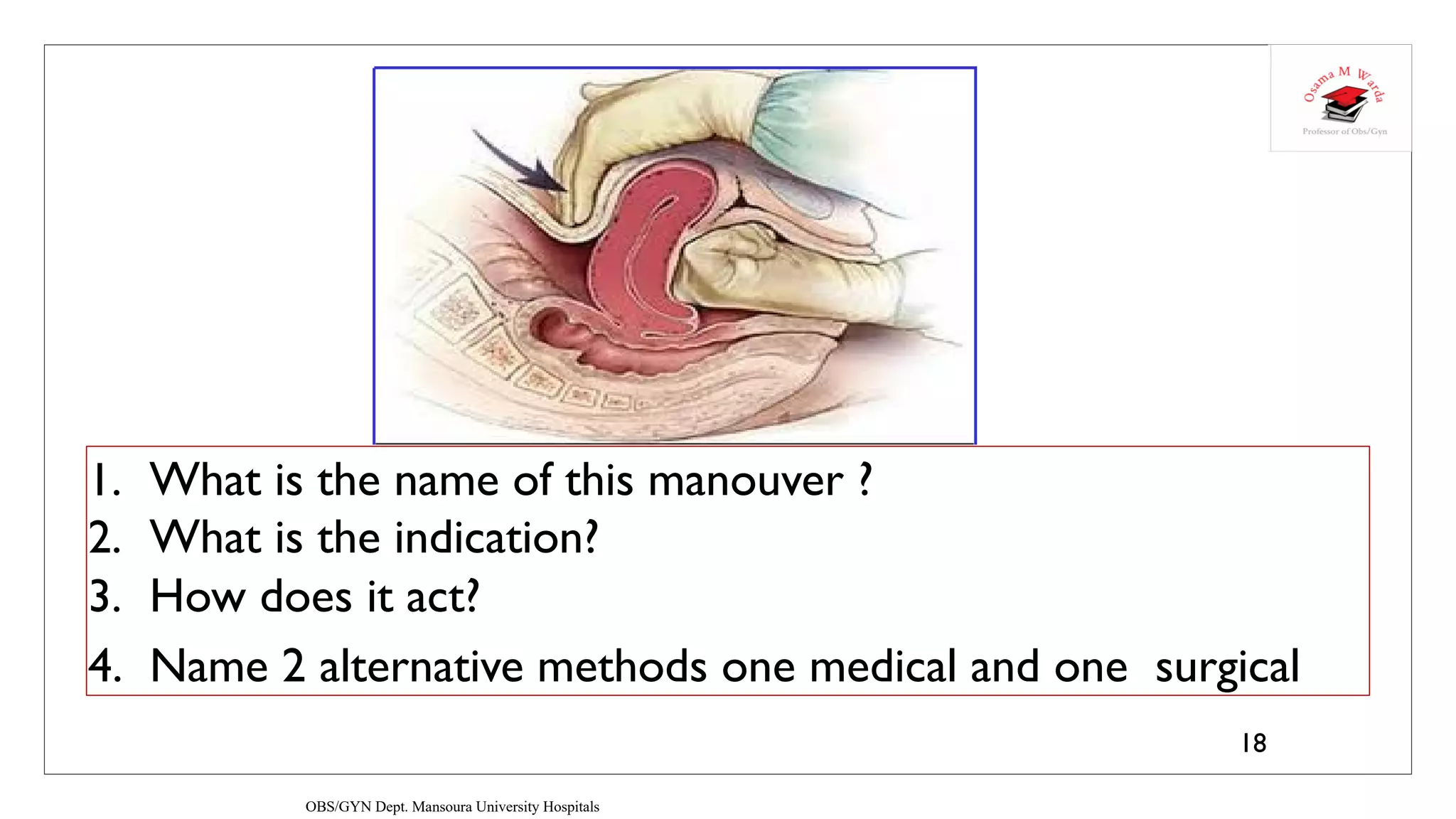 1 Obstetrics & gynecology OSCE -REVISION-1 | PDF