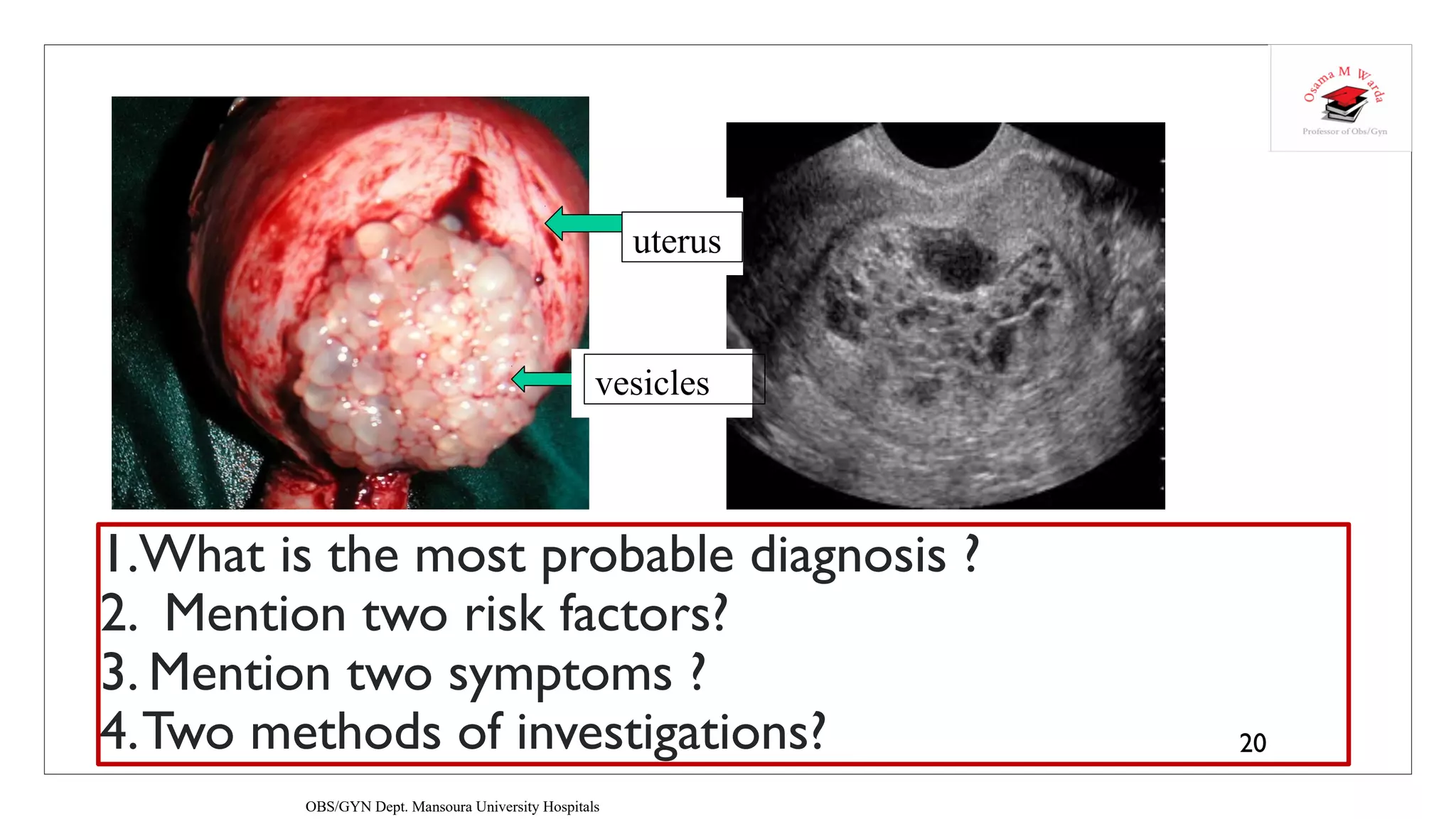 1 Obstetrics & gynecology OSCE -REVISION-1 | PDF