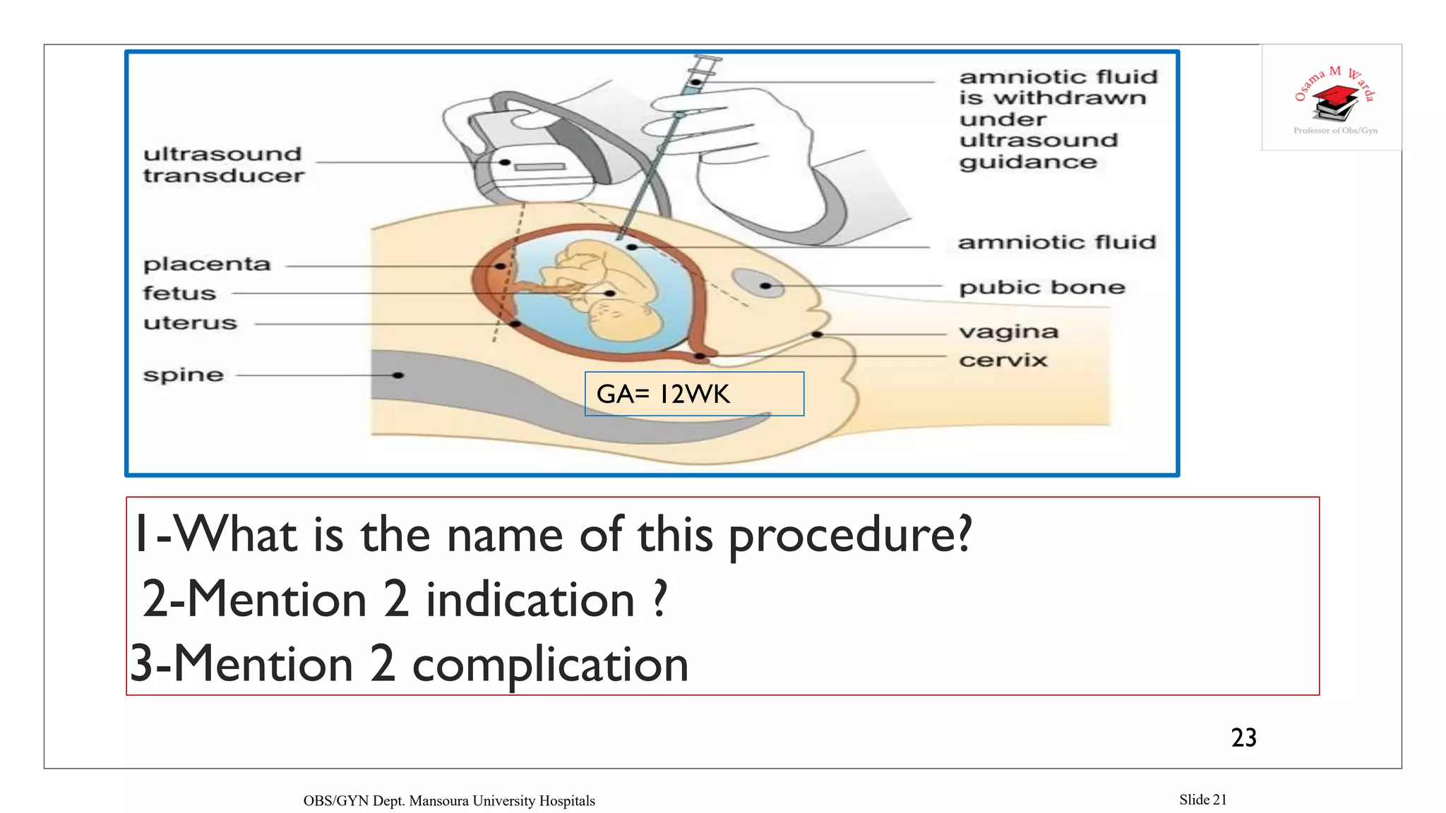1 Obstetrics & gynecology OSCE -REVISION-1 | PDF