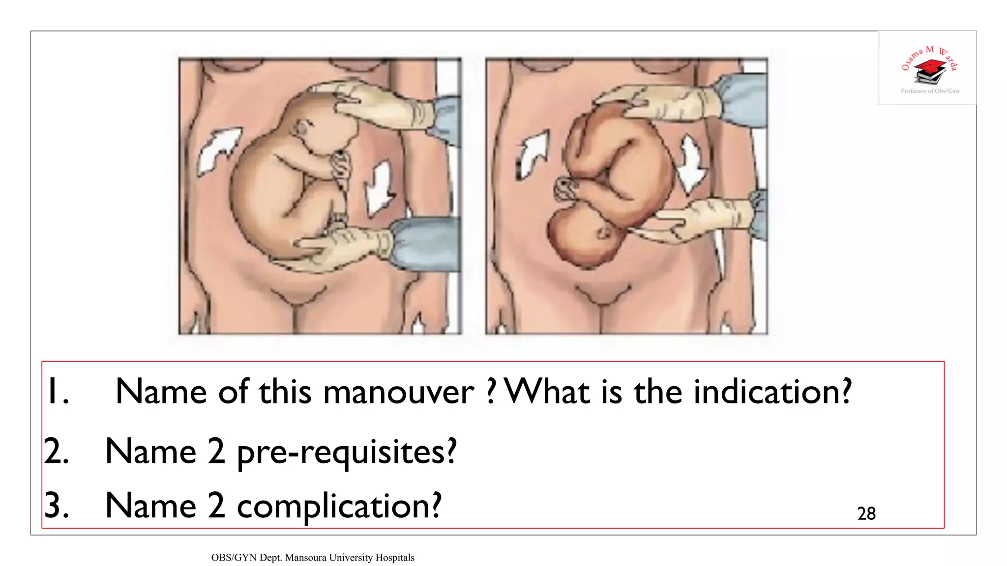 1 Obstetrics & gynecology OSCE -REVISION-1 | PDF