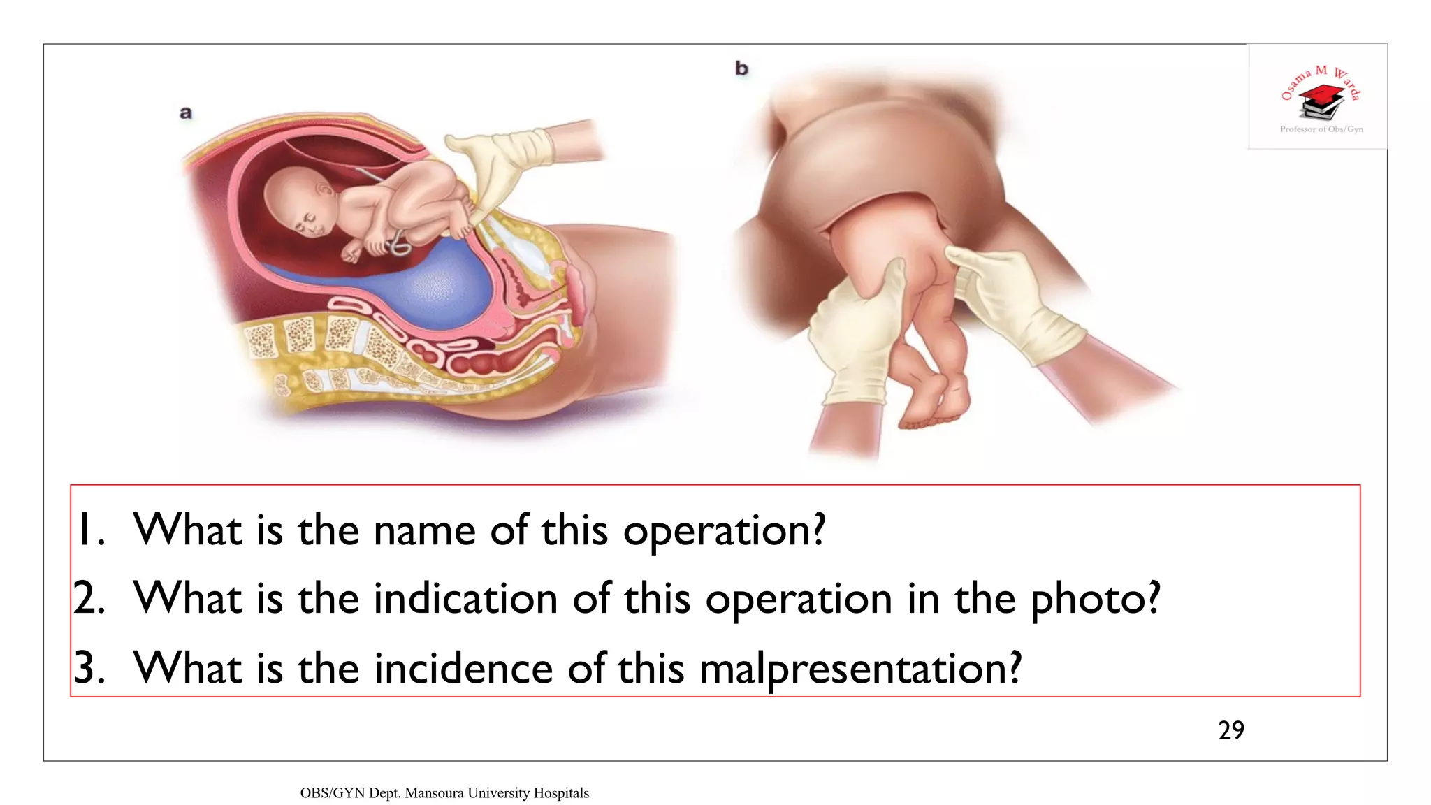 1 Obstetrics & gynecology OSCE -REVISION-1 | PDF