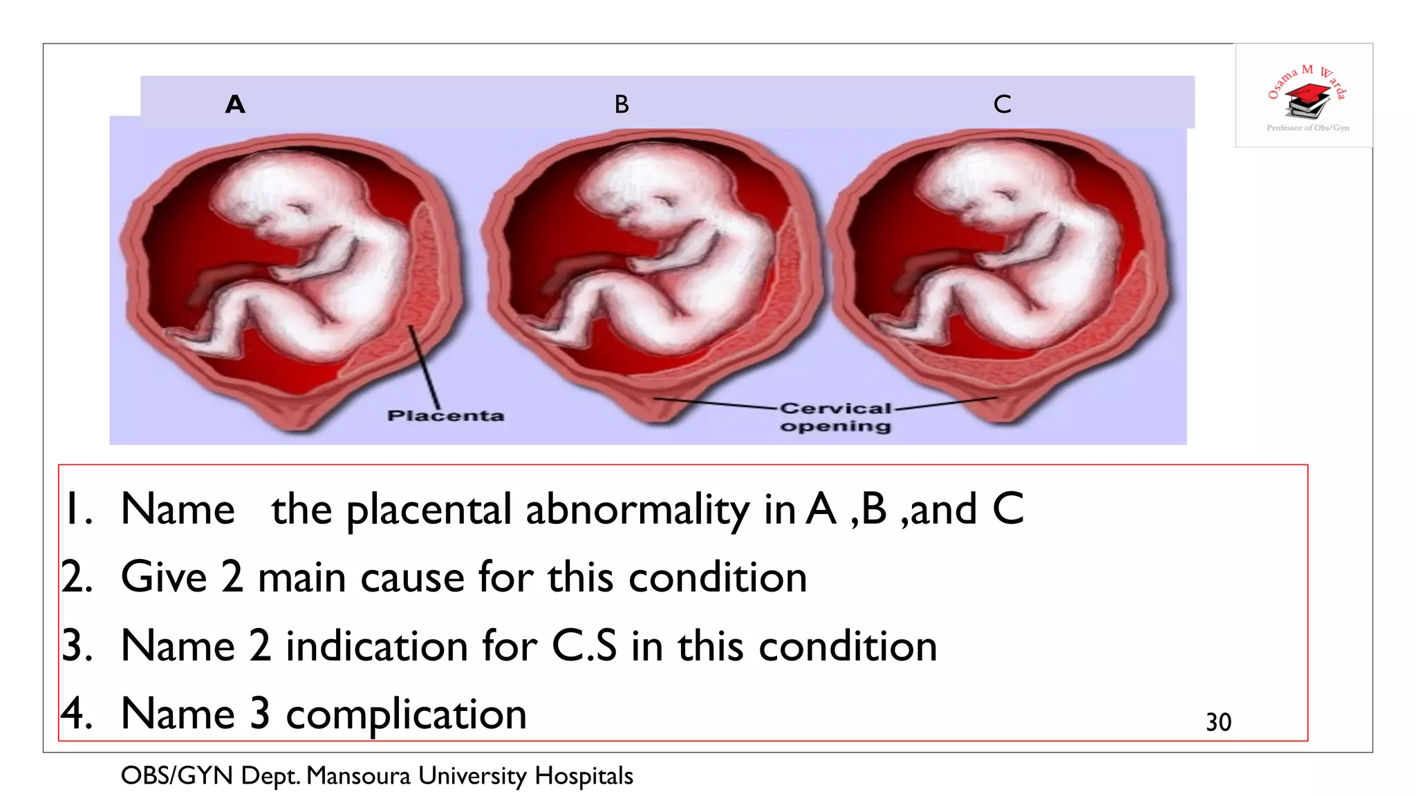 1 Obstetrics & gynecology OSCE -REVISION-1 | PDF