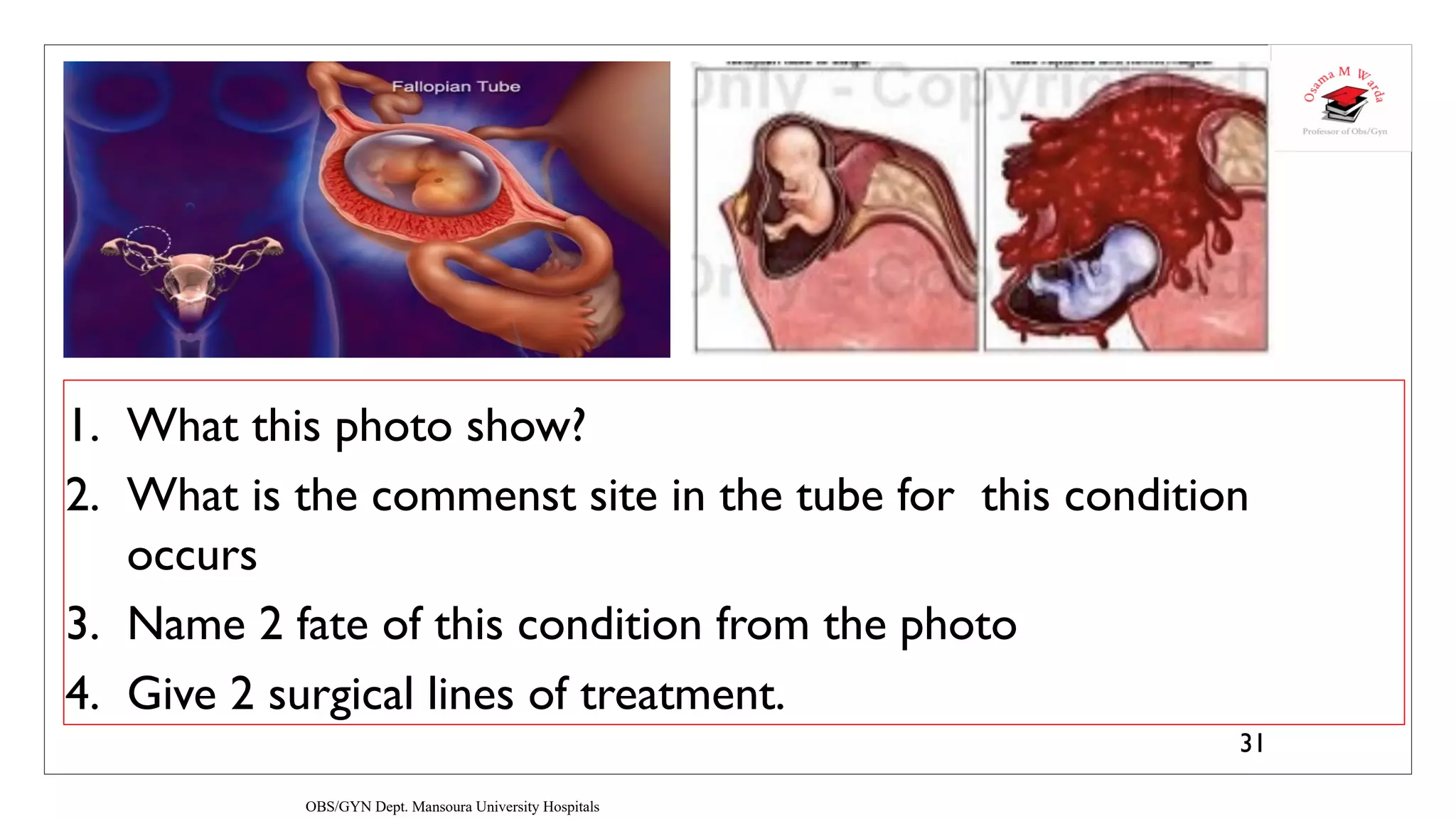 1 Obstetrics & gynecology OSCE -REVISION-1 | PDF