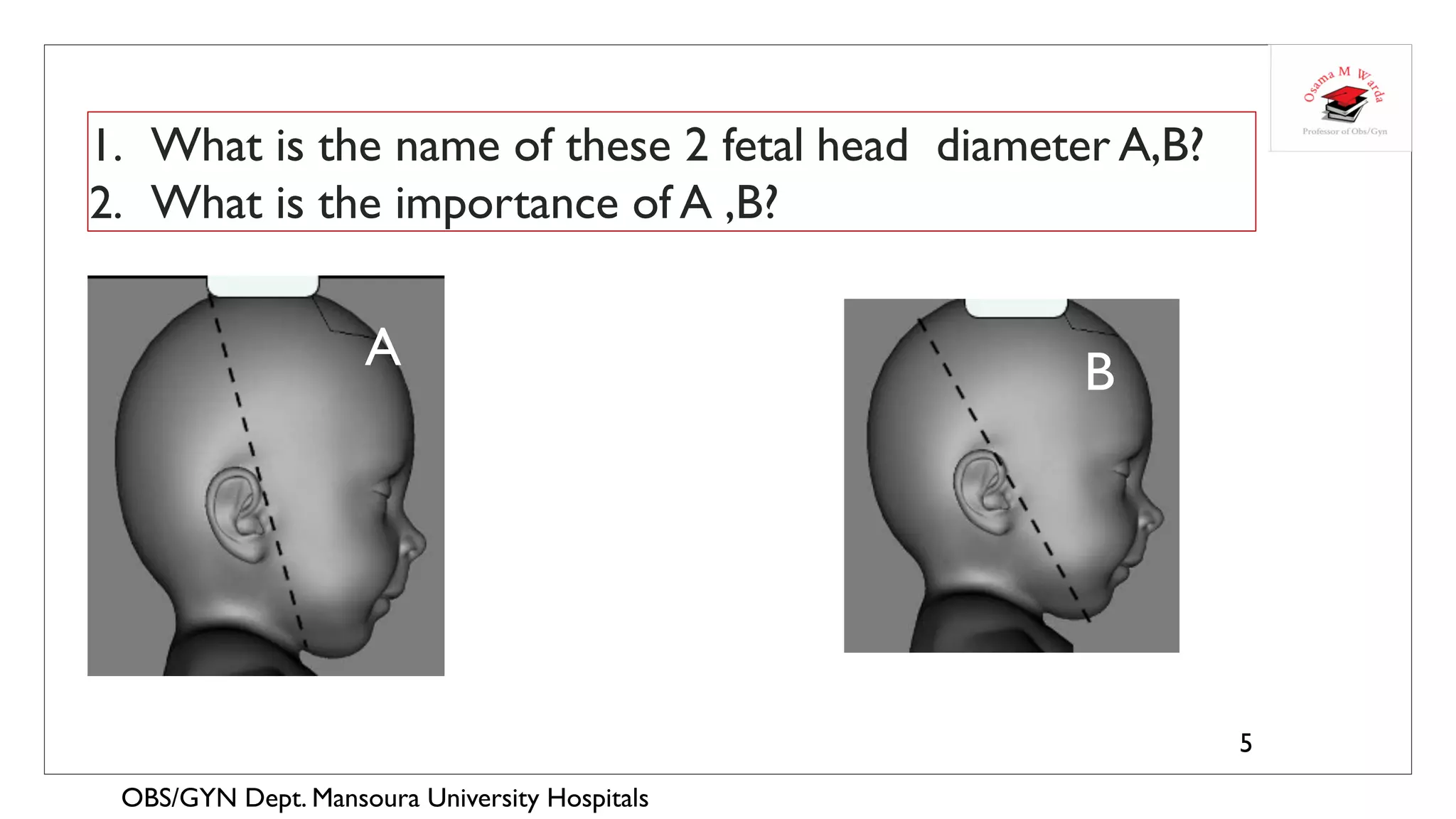 1 Obstetrics & gynecology OSCE -REVISION-1 | PDF