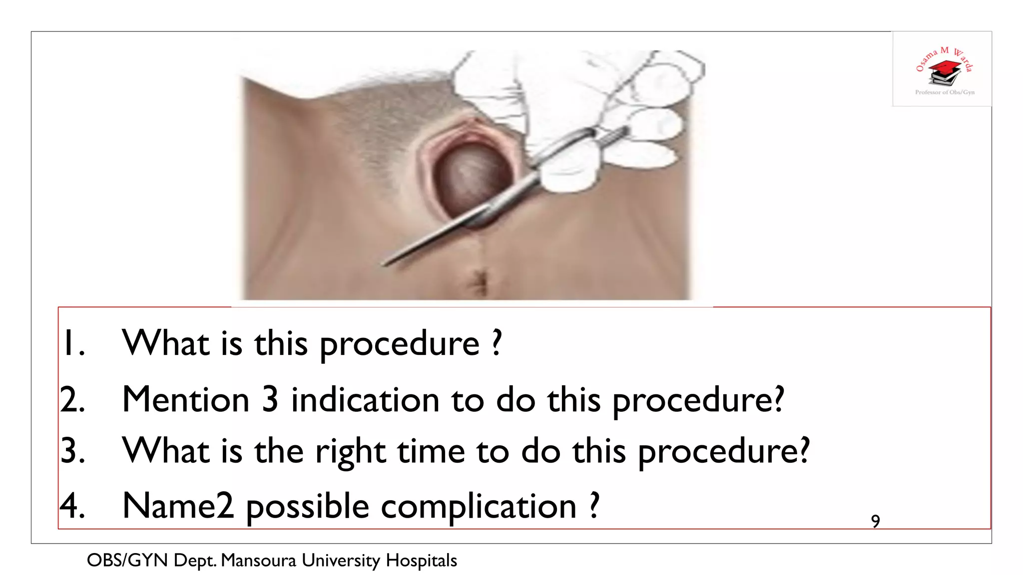 1 Obstetrics & gynecology OSCE -REVISION-1 | PDF