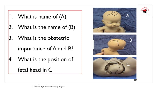 1 Obstetrics & gynecology OSCE -REVISION-1 | PDF | Pregnancy ...