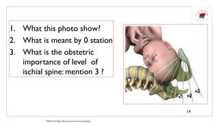 1 Obstetrics & gynecology OSCE -REVISION-1 | PDF