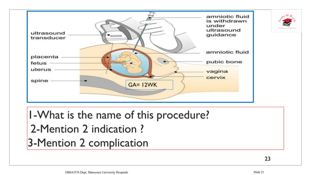 1 Obstetrics & gynecology OSCE -REVISION-1 | PDF | Pregnancy ...