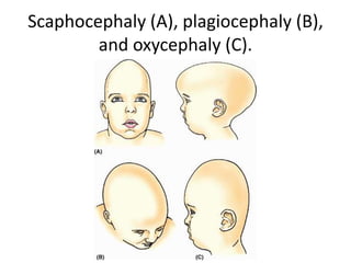 1 osteology of the skull (cranium) | PPTX