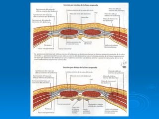 Anatomia de la Pared abdominal-Netter.ppt