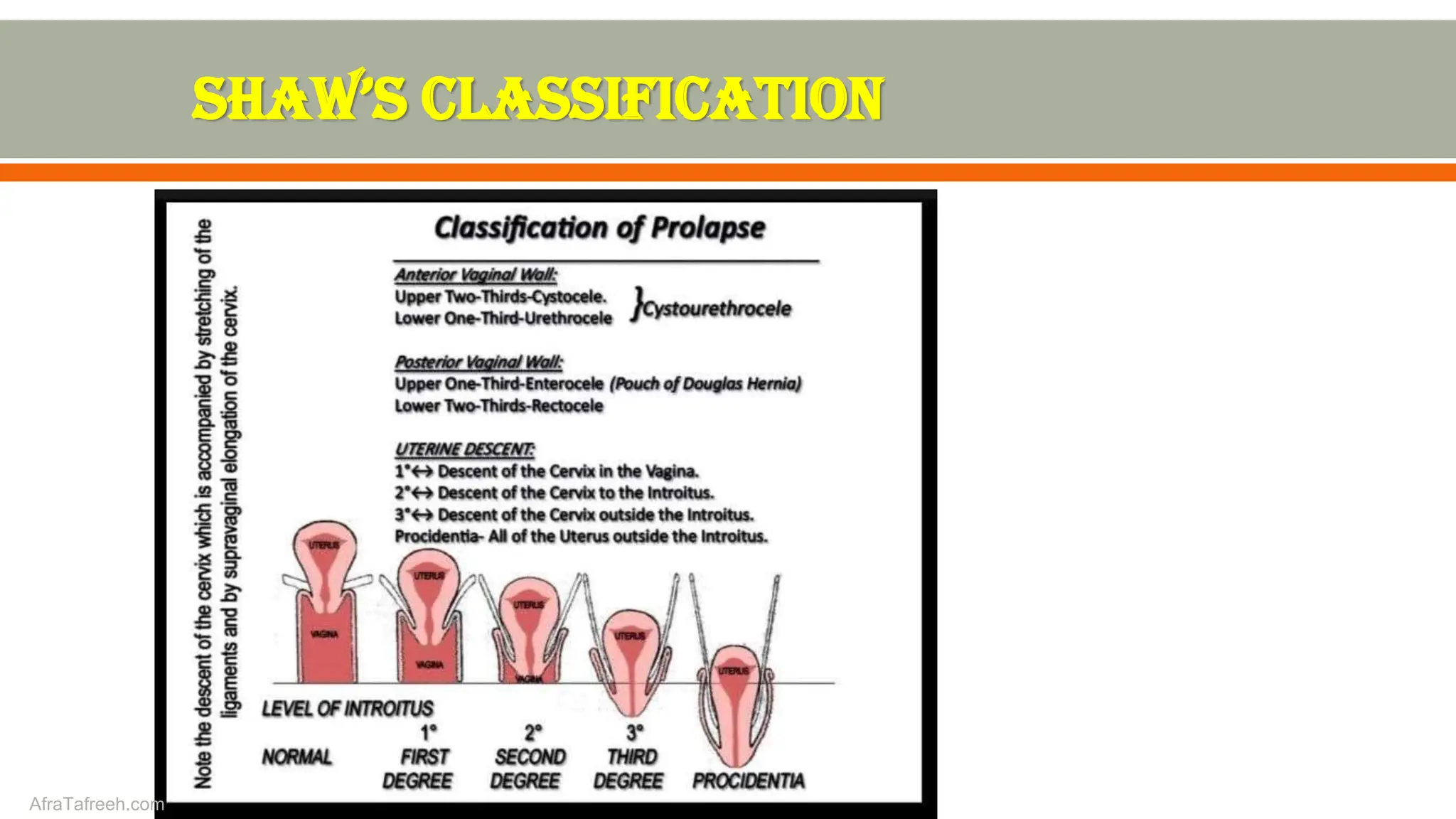 1-Pelvic Organ Prolapse atf.pdf obg and gyn | PDF