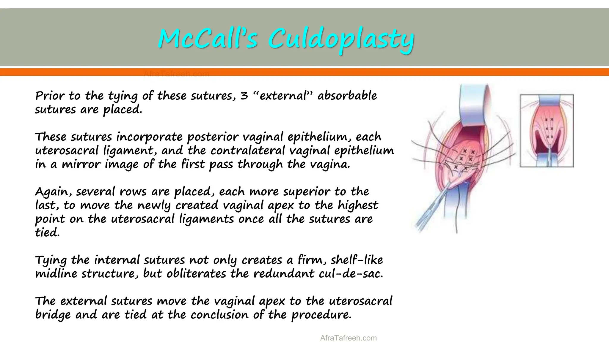 1-Pelvic Organ Prolapse atf.pdf obg and gyn | PDF