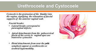 1-Pelvic Organ Prolapse atf.pdf obg and gyn | PDF