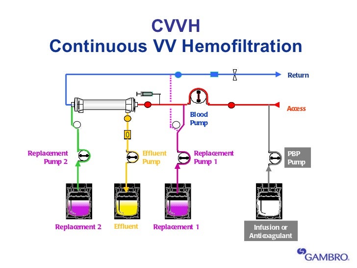 1 prismaflex crrt intro - seg 1 (2007)