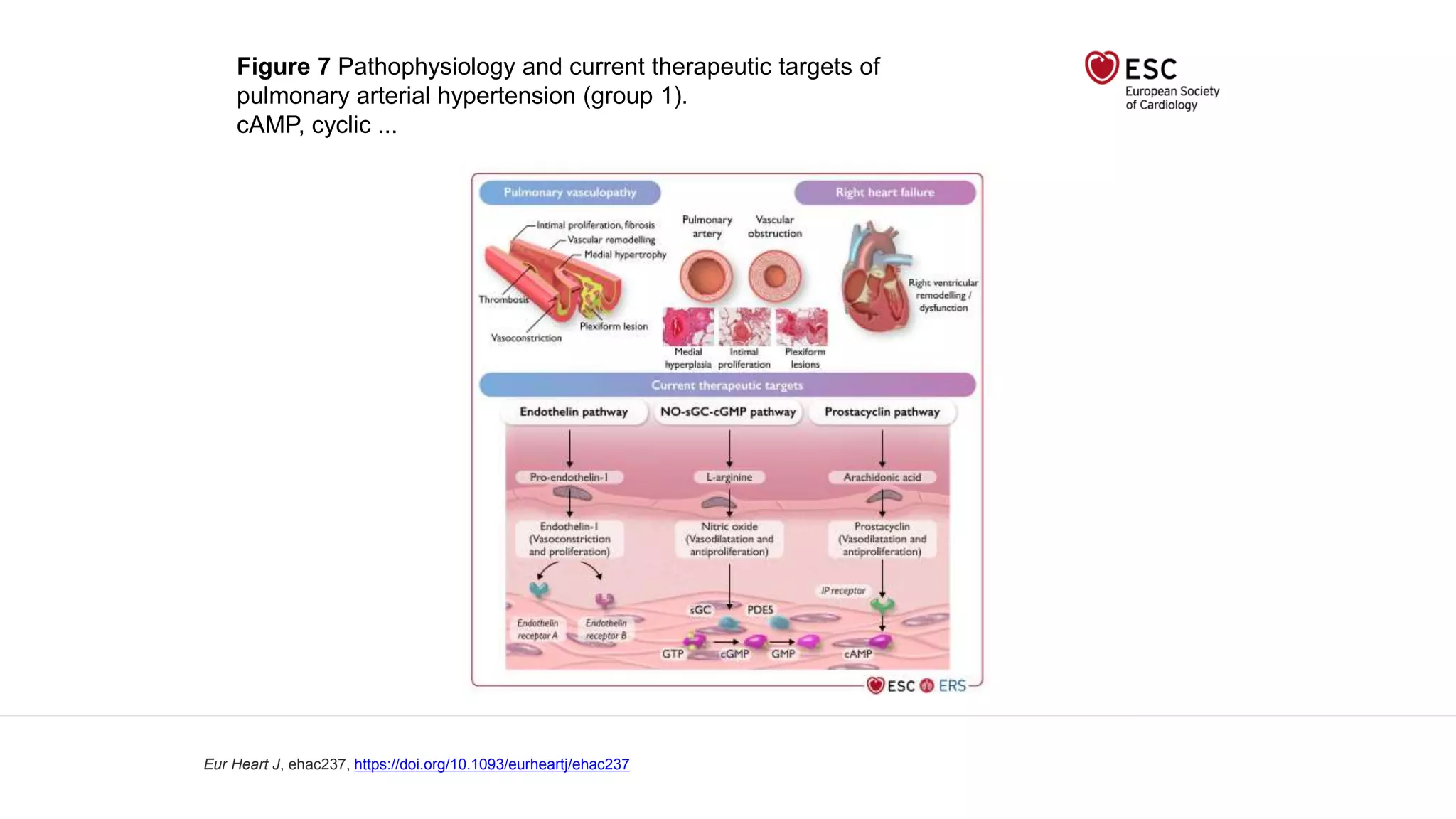 Pulmonary Hypertension Overview 2022.pptx