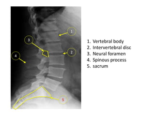1-Radiological anatomy of spine.ppt
