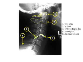1-Radiological anatomy of spine.ppt