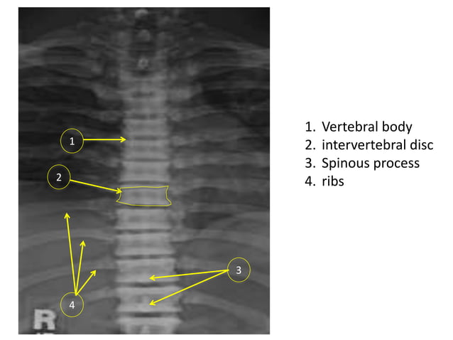 1-Radiological anatomy of spine.ppt