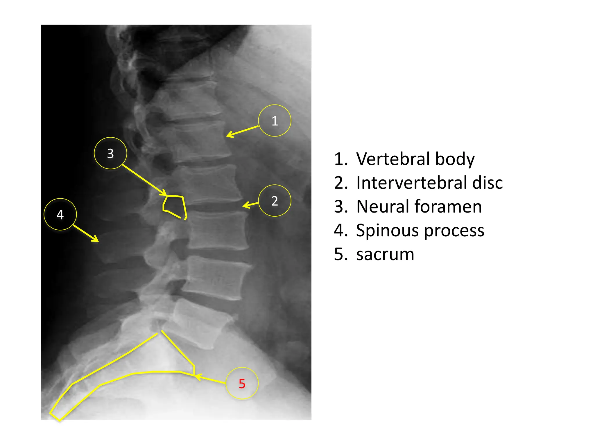 1-Radiological anatomy of spine.ppt by a doctor | PPT
