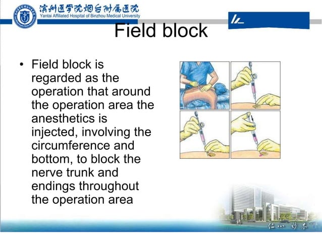 Reginal Block Anesthesia-anesthesia topic | PPT