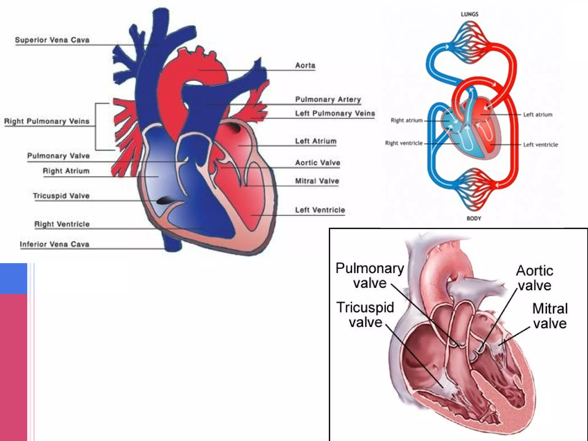 CVS Pathology 1 - Rheumatic heart disease, infective endocarditis and ...