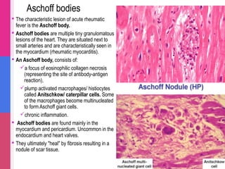 CVS Pathology 1 - Rheumatic heart disease, infective endocarditis and ...