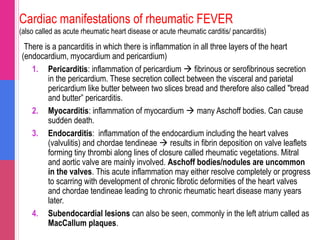 CVS Pathology 1 - Rheumatic heart disease, infective endocarditis and ...