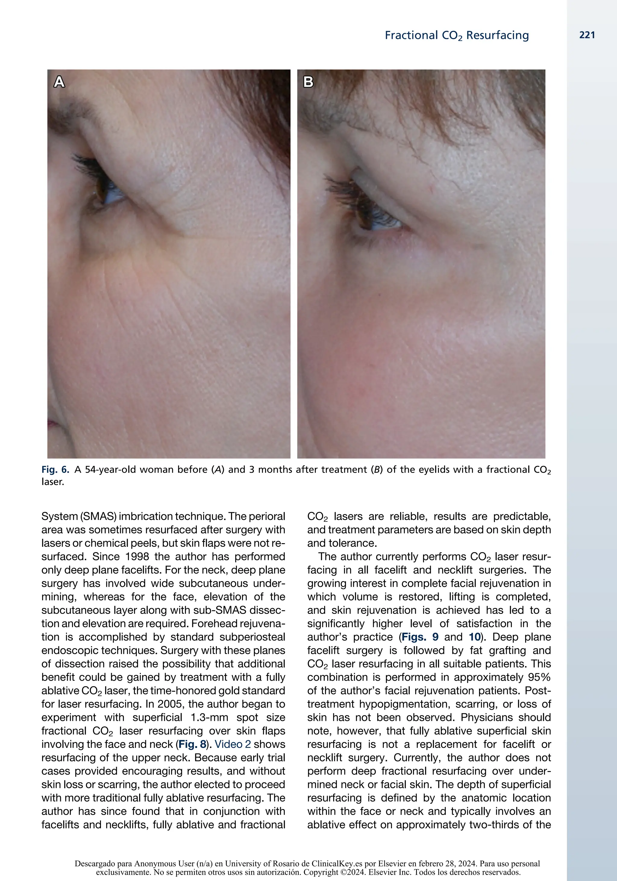 fractional co2 resurfacing has it replacer ablative resurfacin ...