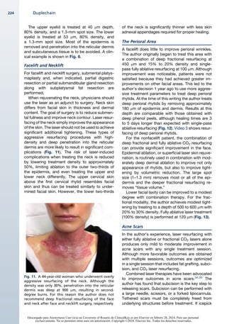 fractional co2 resurfacing has it replacer ablative resurfacin ...