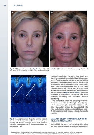 fractional co2 resurfacing has it replacer ablative resurfacin ...