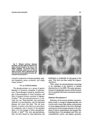 The Mucopolysaccharidoses and Related conditions | PDF