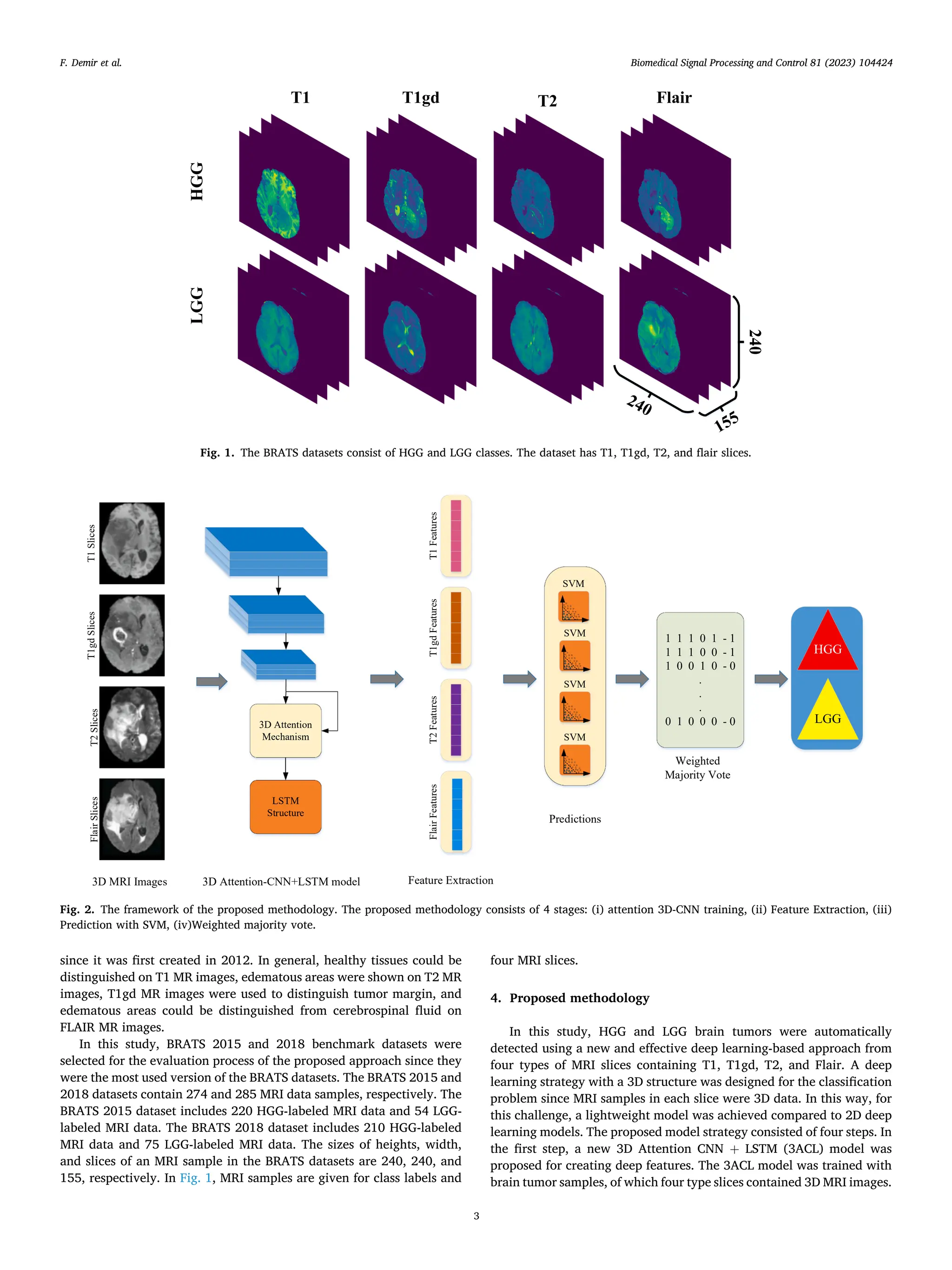 Improving brain tumor classification performance with an effective approach based on new deep ...