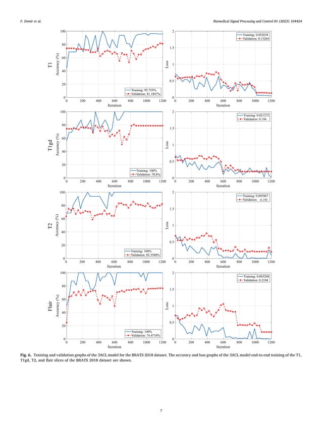 Improving brain tumor classification performance with an effective ...