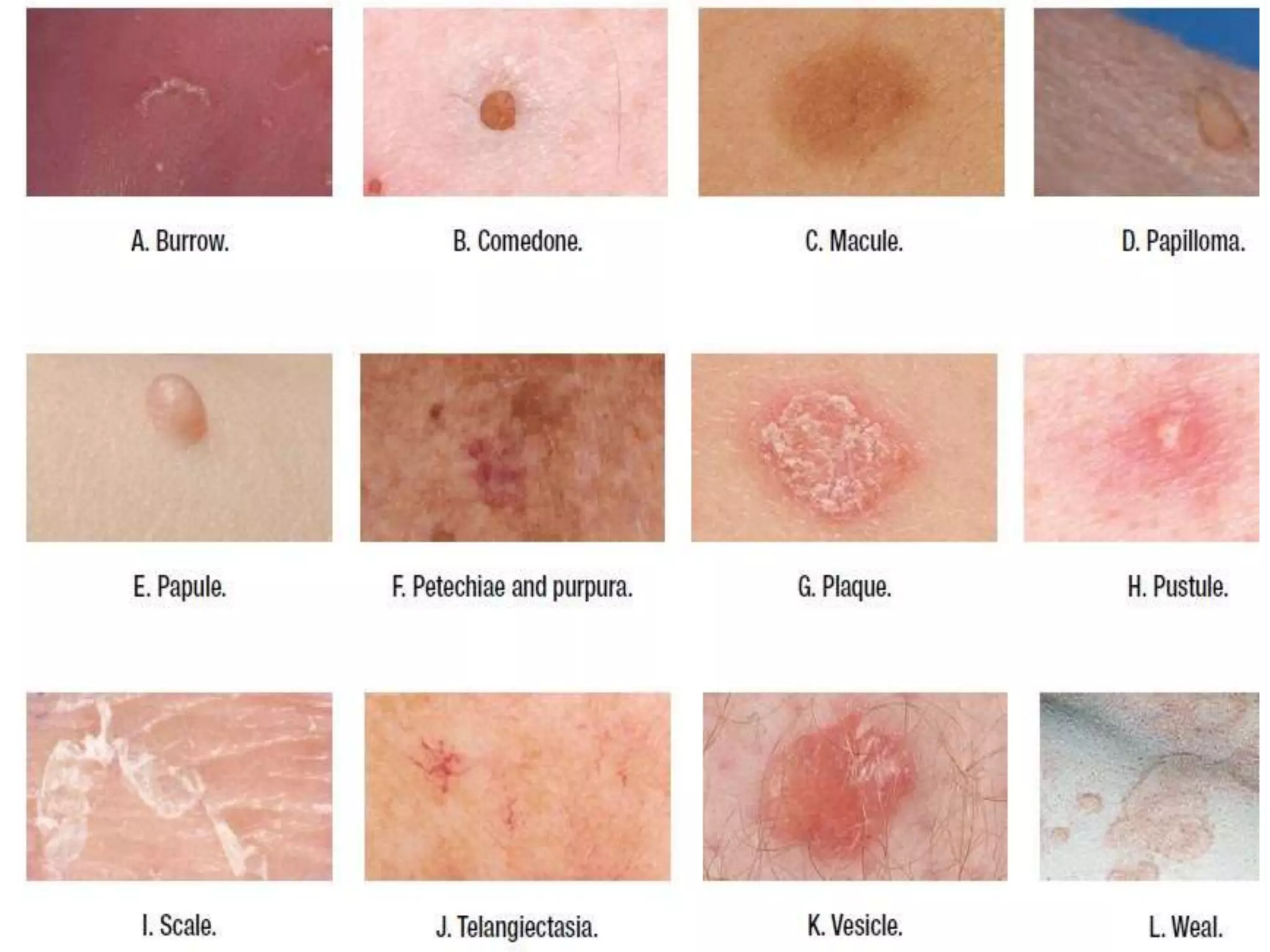 1 skin rash | PPTX | Infectious Diseases | Diseases and Conditions