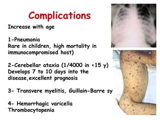 Mycoplasma Pneumonia Rash