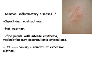 Salmonella Symptoms Rash