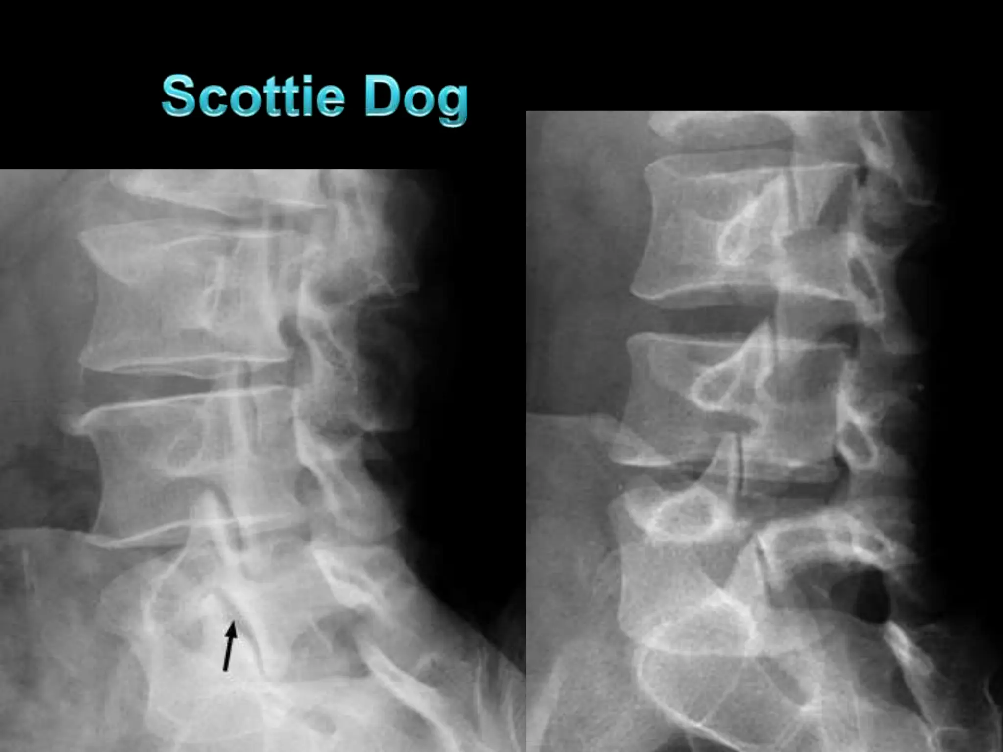 1- spine and brase techniques has specific indications, procedures, and ...